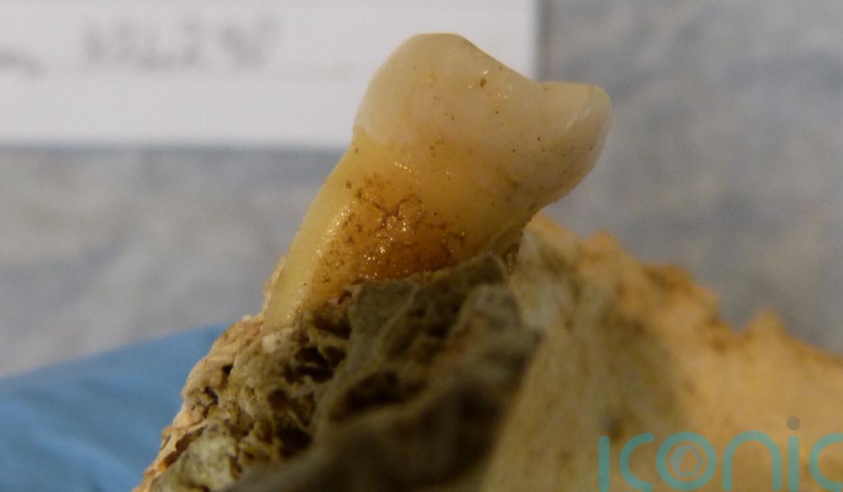 National: Brushing up on the Bronze Age as 4,000-year-old tooth found ...